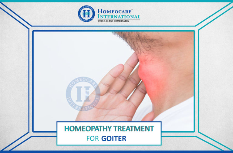 What is a Goiter and What causes it? | Homeocare International