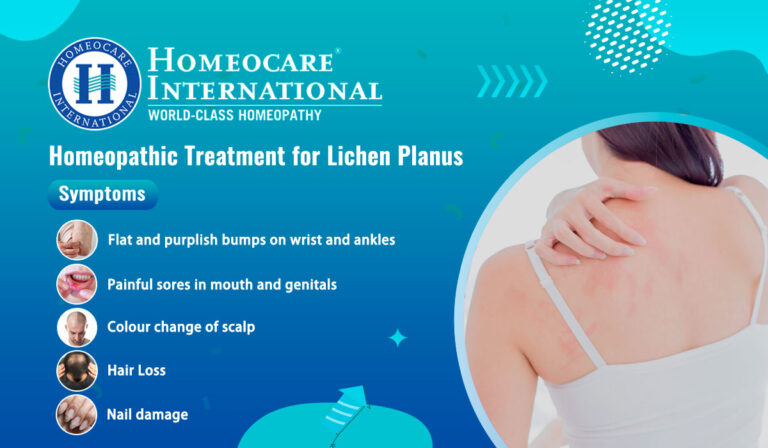 Homeopathic Treatment for Lichen Planus | Homeocare International